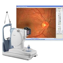 Focal Point Optometrists - Retinal Camera and Photography